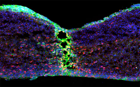 Our Research | Zhigang He Laboratory
